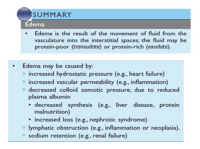 Edema | PPT