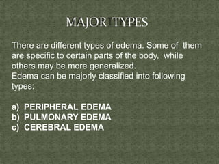 edema-210412060249.pdf