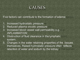 edema-210412060249.pdf