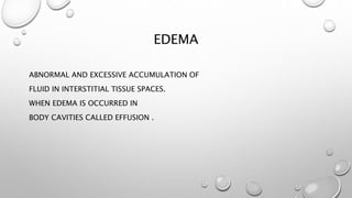 edema.pptx