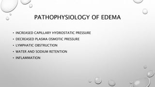 edema.pptx
