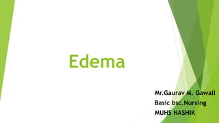 edema.pptx | Medical Health