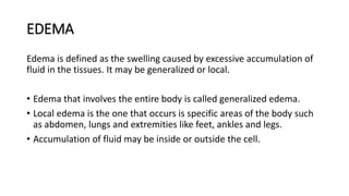 edema.pptx