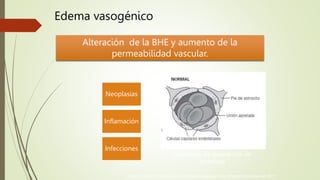 EDEMA.pptx