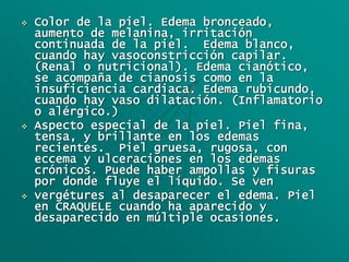 edema..ppt