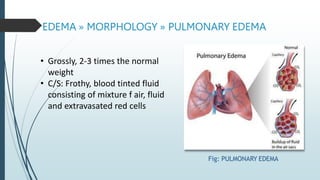 Pathophysiology of edema and its applied aspects | PPTX