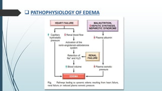Pathophysiology of edema and its applied aspects | PPT