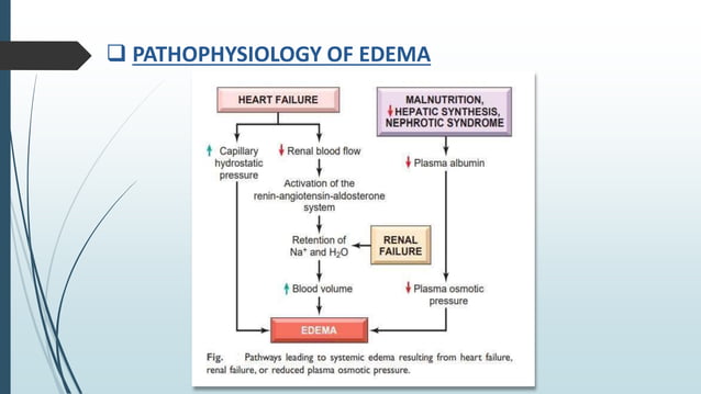 Pathophysiology of edema and its applied aspects | PPT