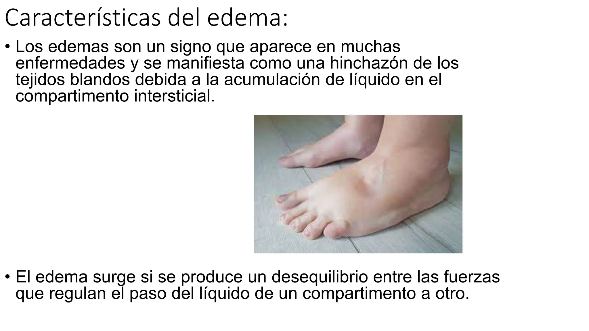 edema.pptx trabajo para que las personas | PPTX | Women\'s Health ...