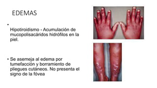 edema.pptx trabajo para que las personas | PPTX