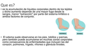 edema.pptx trabajo para que las personas | PPTX
