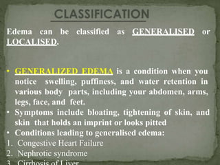 Edema.111111111111111111111111111111pptx | PPT