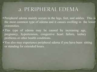 Edema.111111111111111111111111111111pptx | PPTX