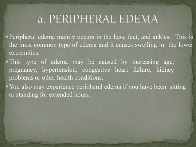 Edema.111111111111111111111111111111pptx | PPT