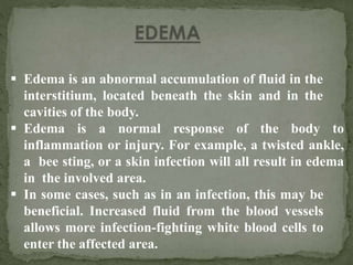 Edema.111111111111111111111111111111pptx | PPT
