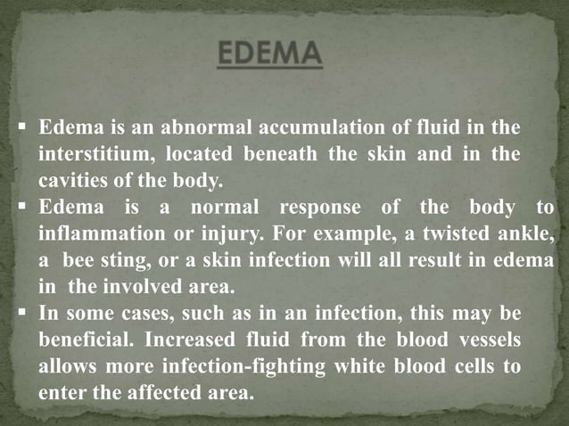 Edema.111111111111111111111111111111pptx | PPT