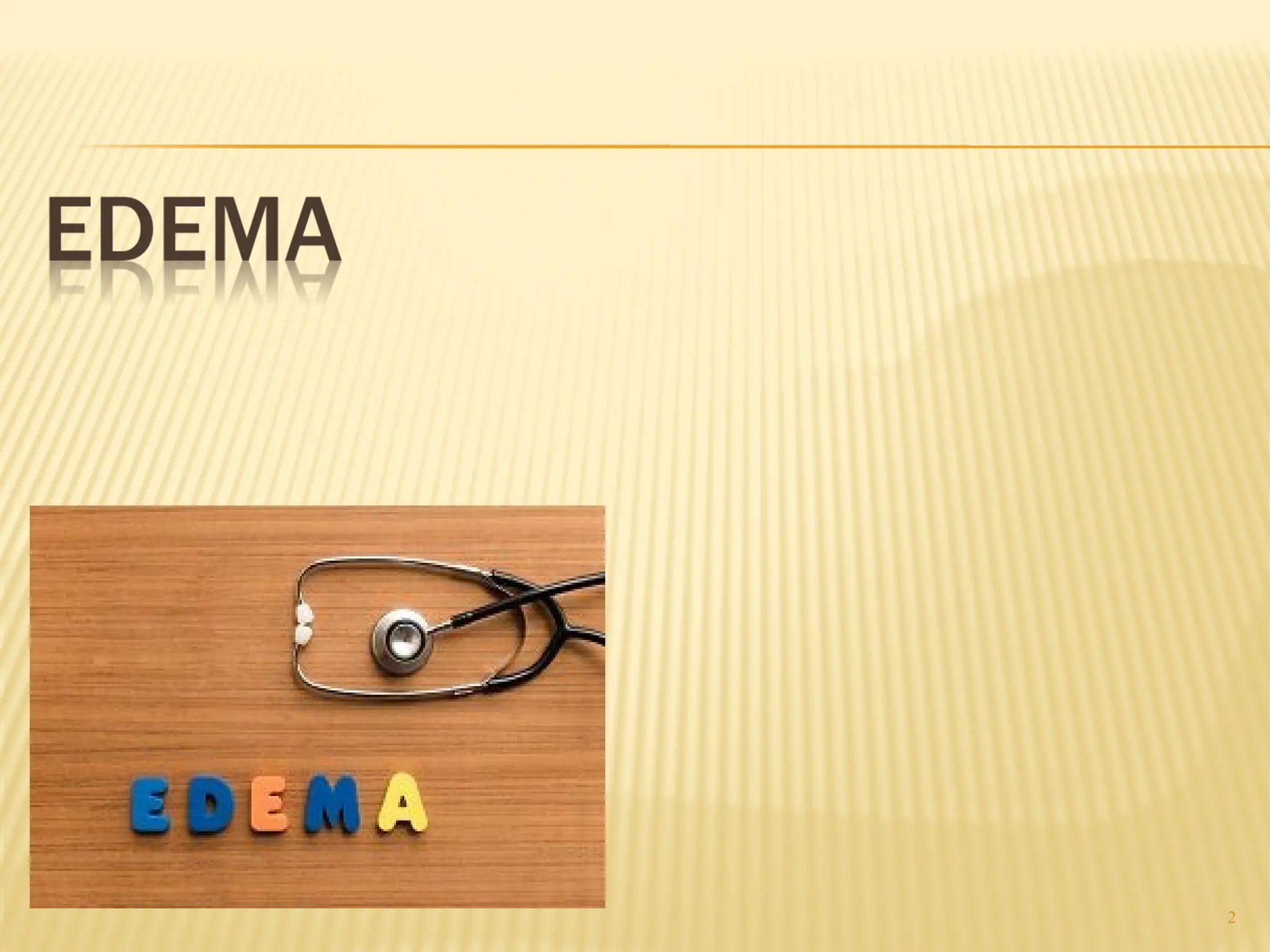 edema.ppt edema.ppt edema.ppt edema.pptedema.ppt