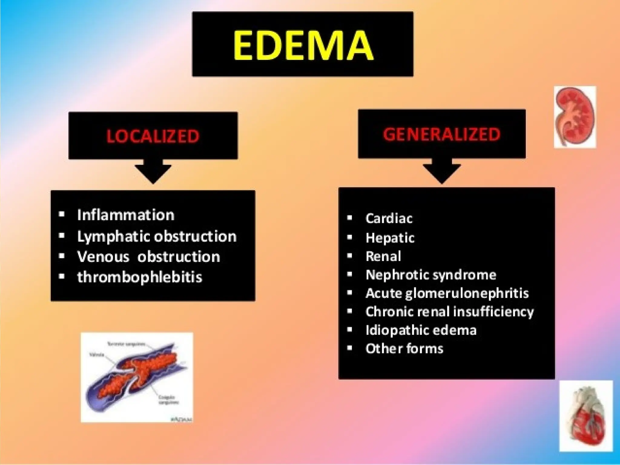 edema.ppt edema.ppt edema.ppt edema.pptedema.ppt