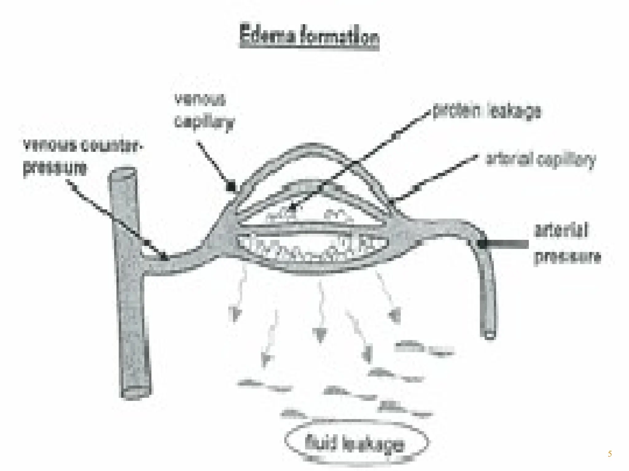 edema.ppt edema.ppt edema.ppt edema.pptedema.ppt