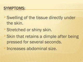 edema.ppt edema.ppt edema.ppt edema.pptedema.ppt