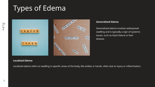Edema | Definition, Causes, symptoms & diagnosis | PPTX