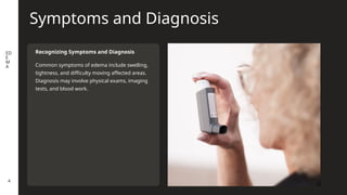 Edema | Definition, Causes, symptoms & diagnosis | PPTX
