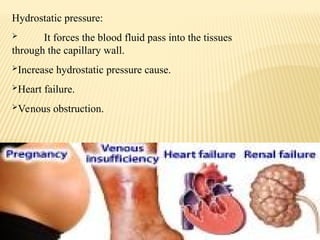 Edema and Their Consequences details description | PPT