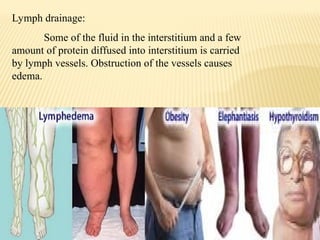 Edema and Their Consequences details description | PPT