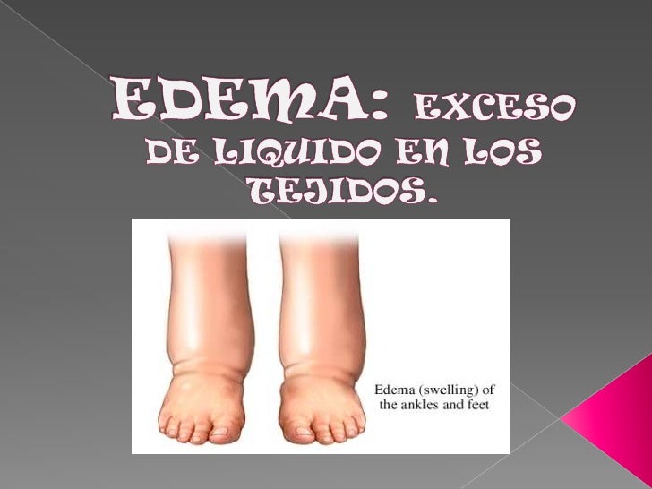 COMPARTIMIENTOS DEL LÍQUIDO CORPORAL – JUAN HERNANDEZ ESPINOZA