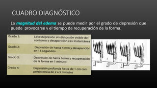 Edema periferico-semiologia | PPTX