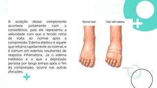 Edema - Semiologia.pptx