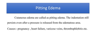 edema_1.pptx important for nurses to recognise the types of edemdemas ...