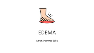edema apresentation on edema _122548.pptx