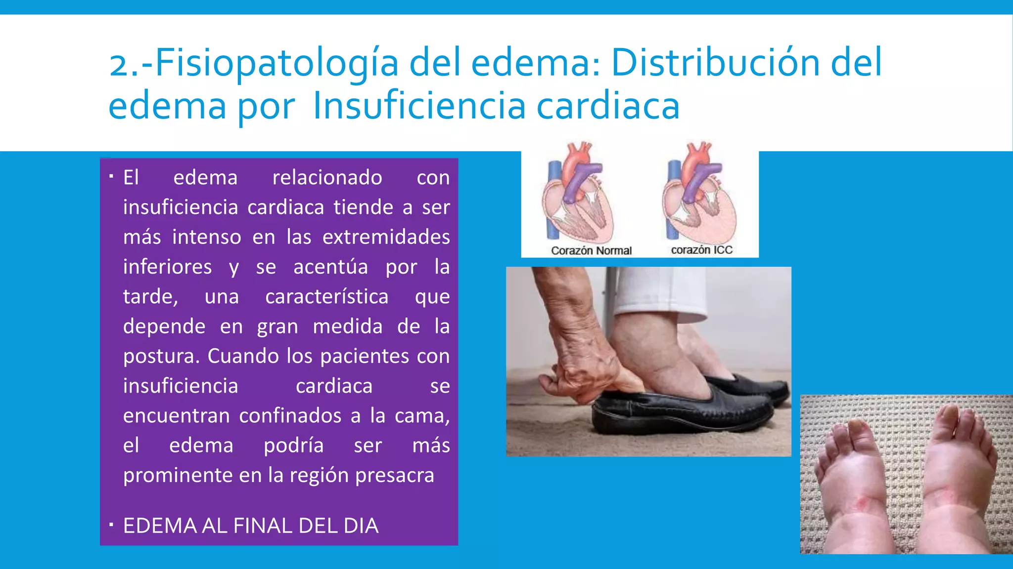 EDEMA 1 PARTE.pptx