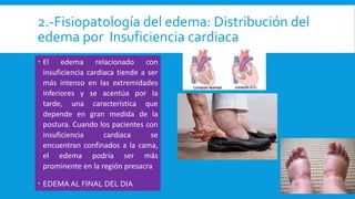 EDEMA 1 PARTE.pptx