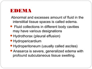 Edema | PPT