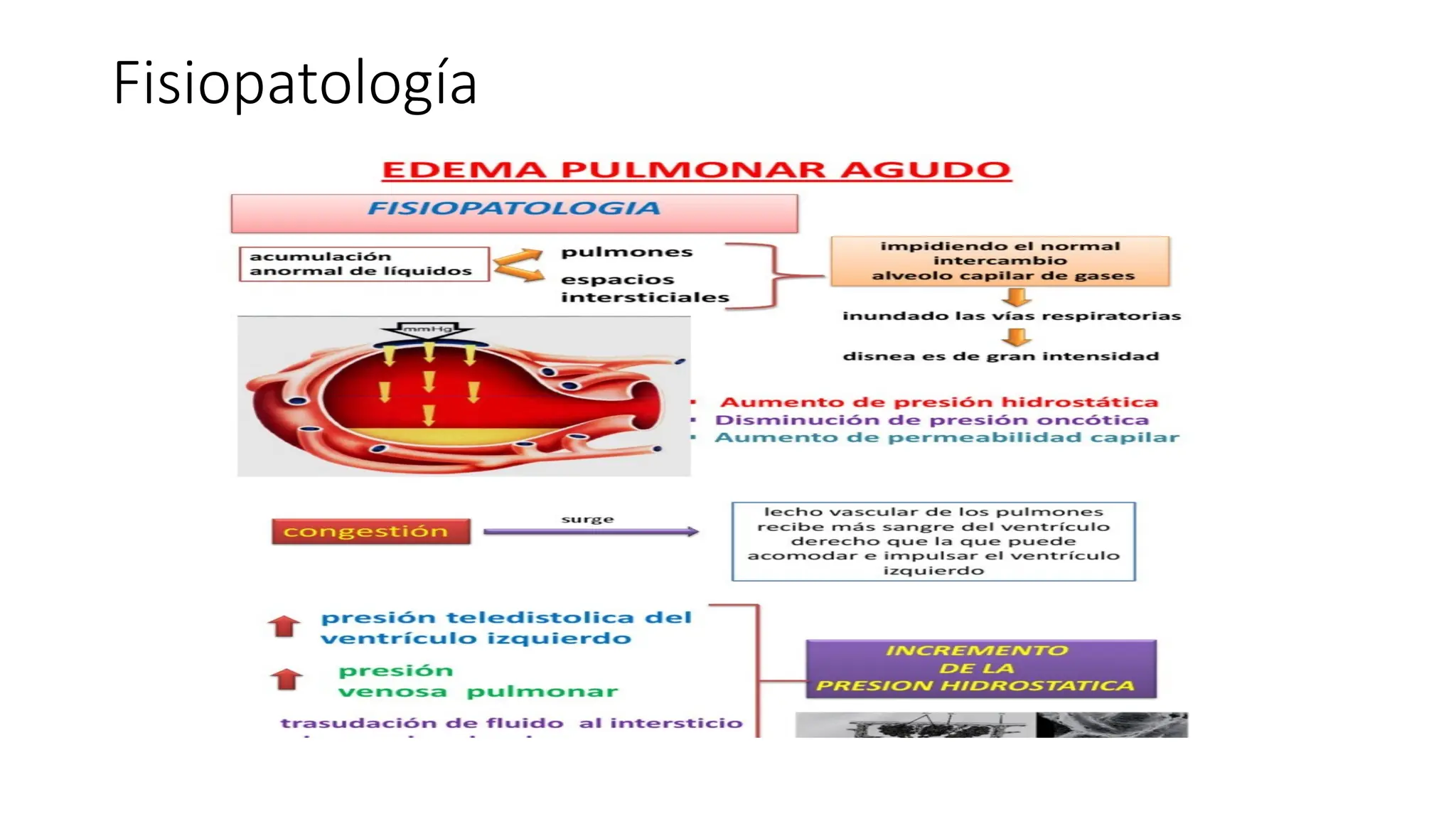 Edema agudo de pulmón cardiogénico Dr. Regalado A Nueva.pptx