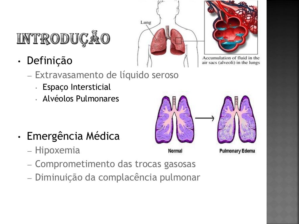 Edema Pulmonar: O Que É E Quais As Suas Consequências – BDNE