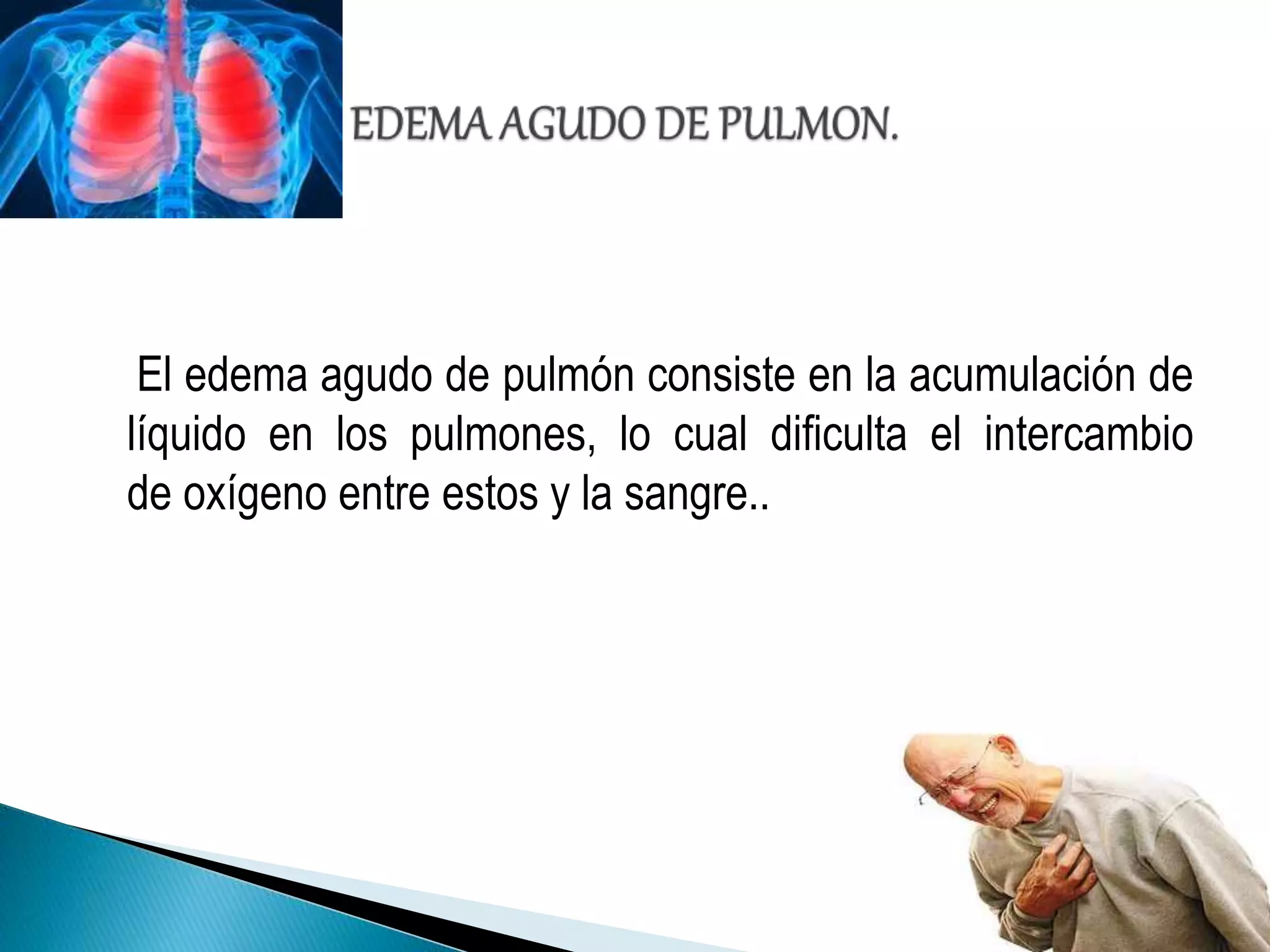 Edema agudo de pulmon | PPTX | Lung and Respiratory Health | Diseases ...