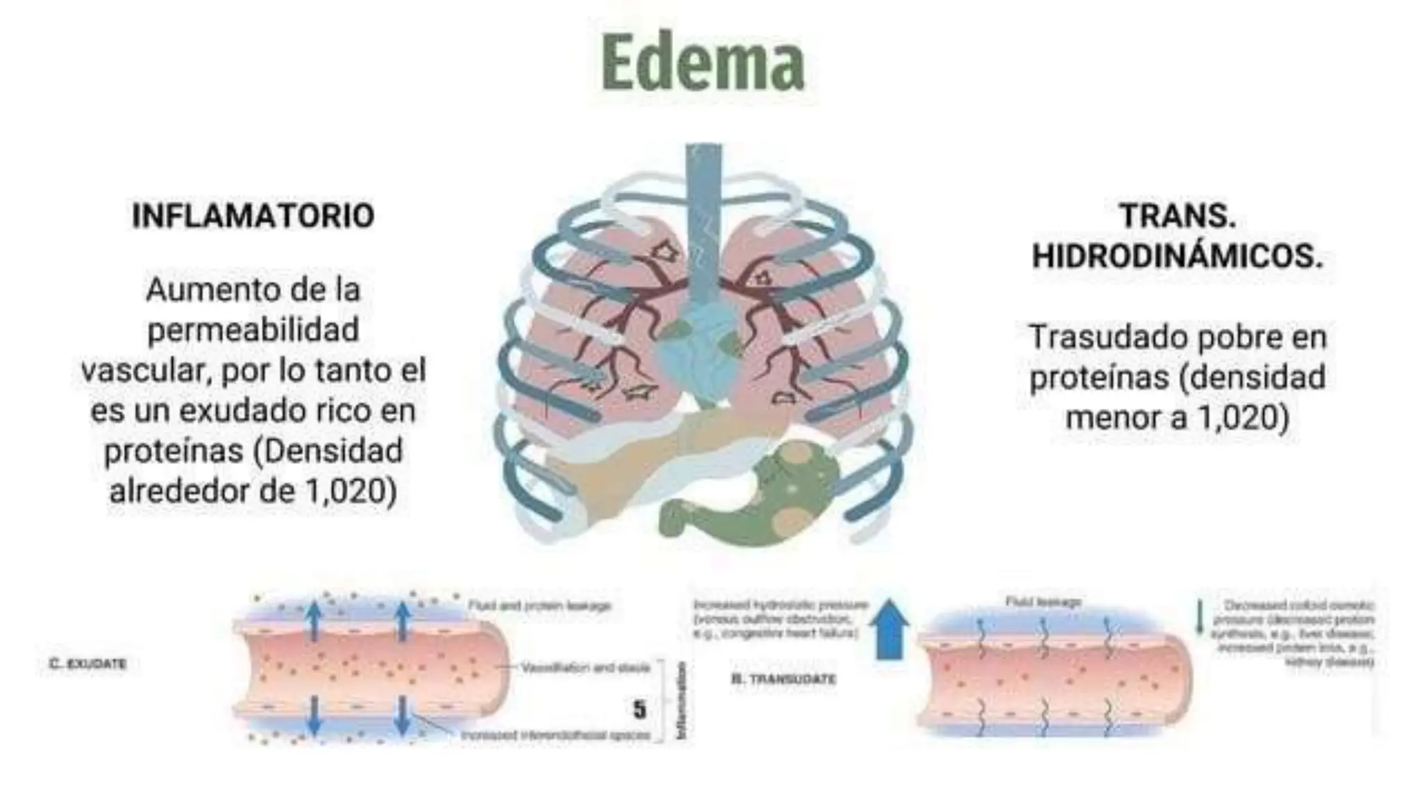 EDEMA AGUDO DE PULMON EN EMERGENCIA DESCRIBE LA FISIOPATOLGIA ...