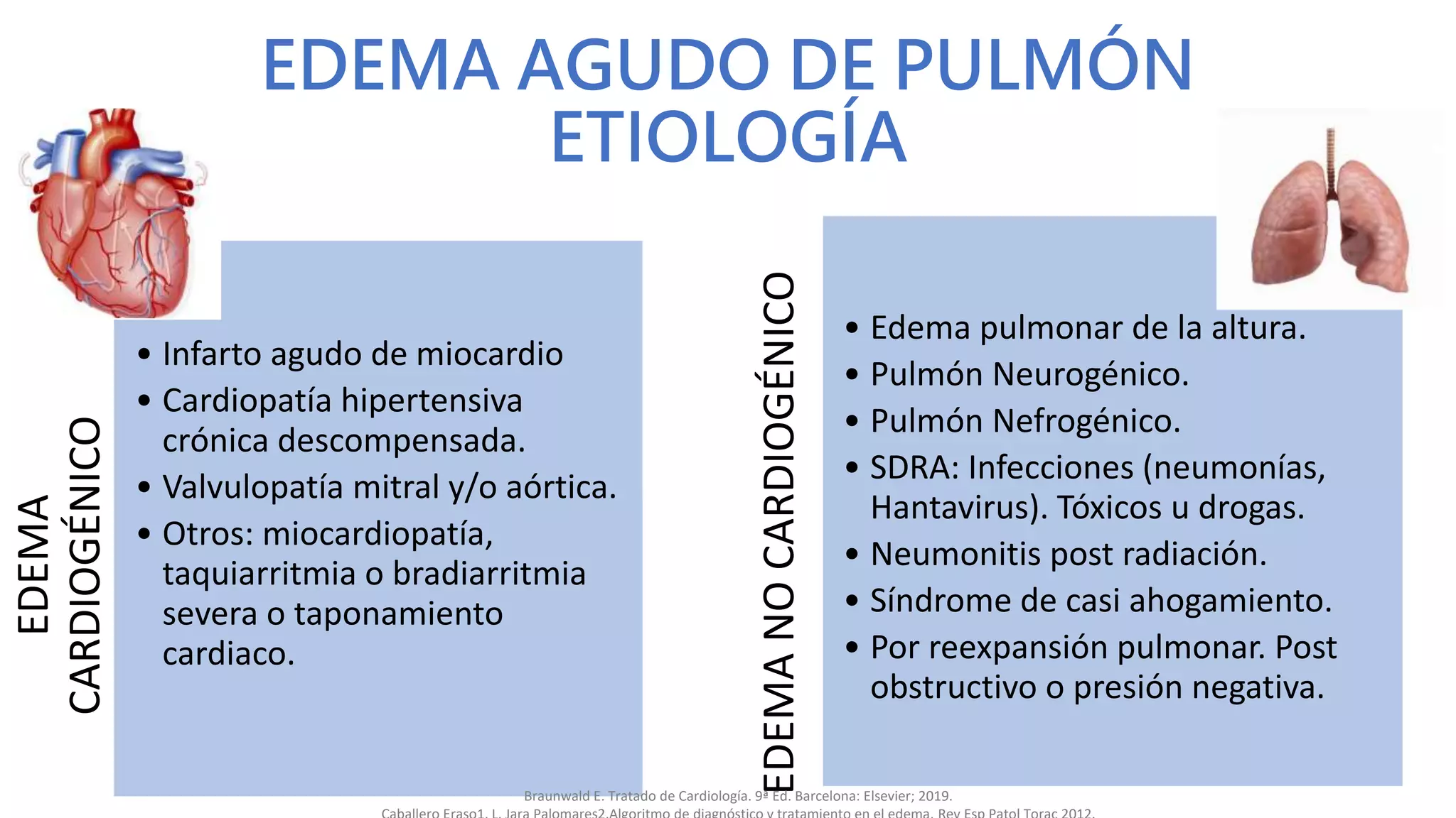 EDEMA AGUDO DE PULMON (1).pptx