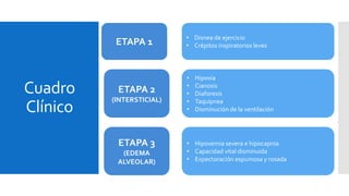 Edema agudo pulmonar | PPTX