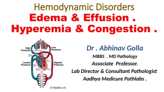 Hemodynamic Disorders . Edema , Effusion , Hyperemia Congestion.pptx Dr ...