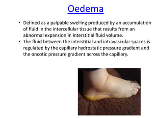 Edema and Malnutrition(Nutrition and Health) | PDF