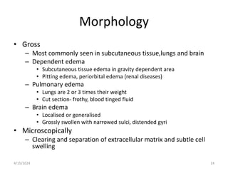 edema and shock Definition, pathogenesis and morphology | PPTX