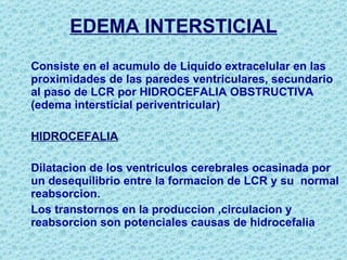 Edema cerebral | PPT