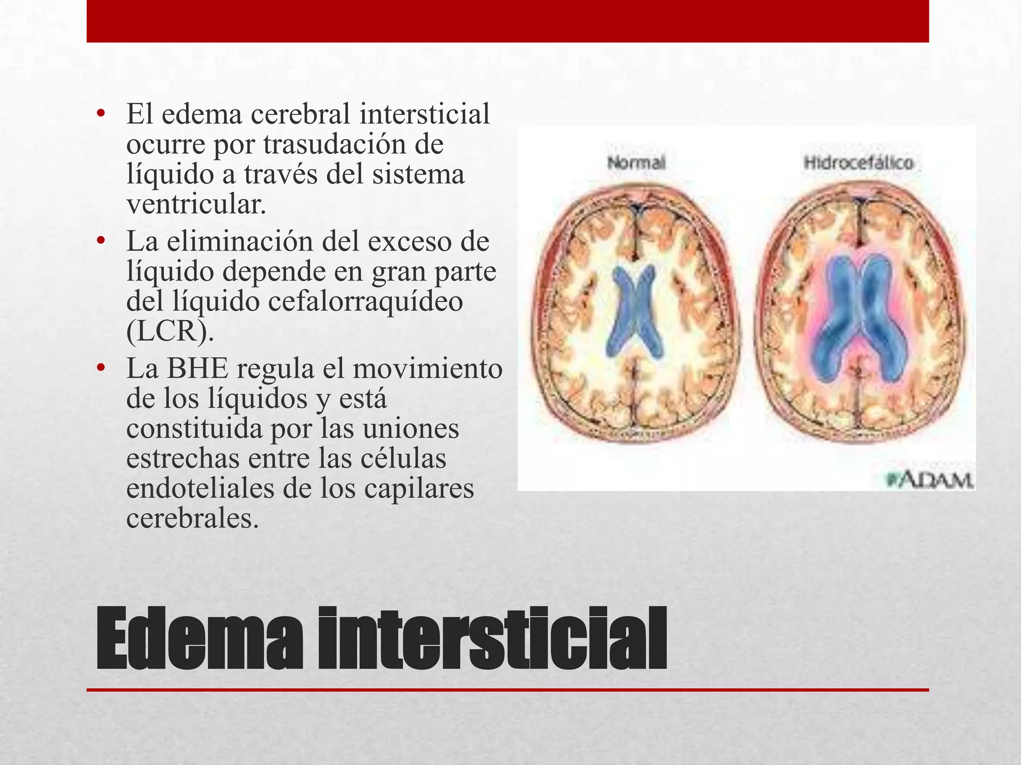 Edema cerebral | PPTX