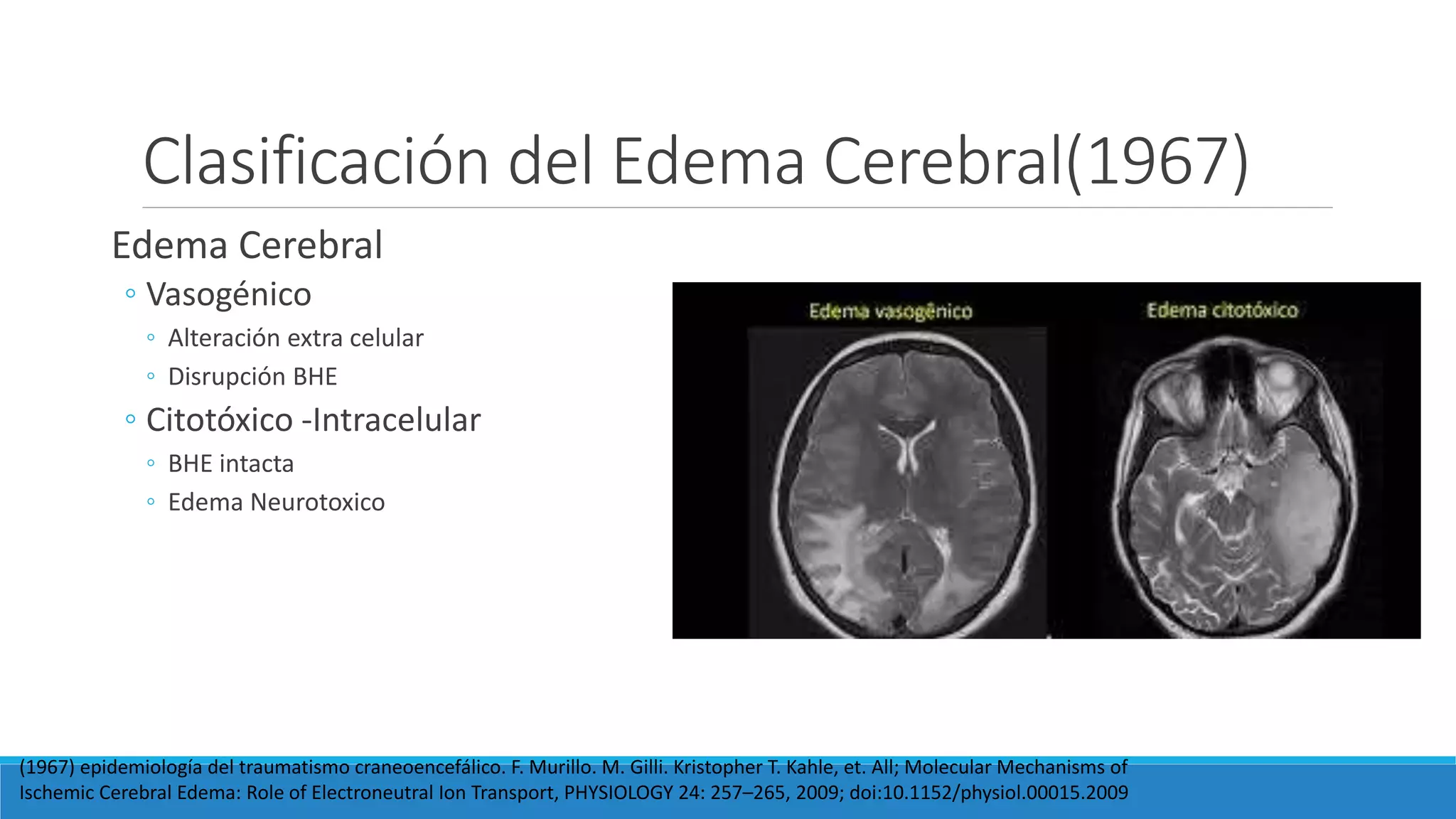 edema cerebral XD.pptx | Brain and Nervous System Disorders | Diseases ...