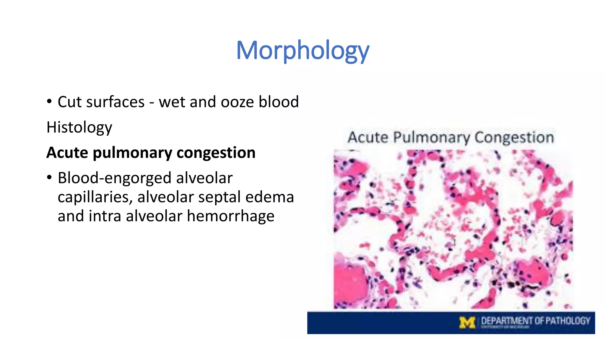 Edema congestion 15th.pdf