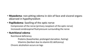 Edema congestion 15th.pdf
